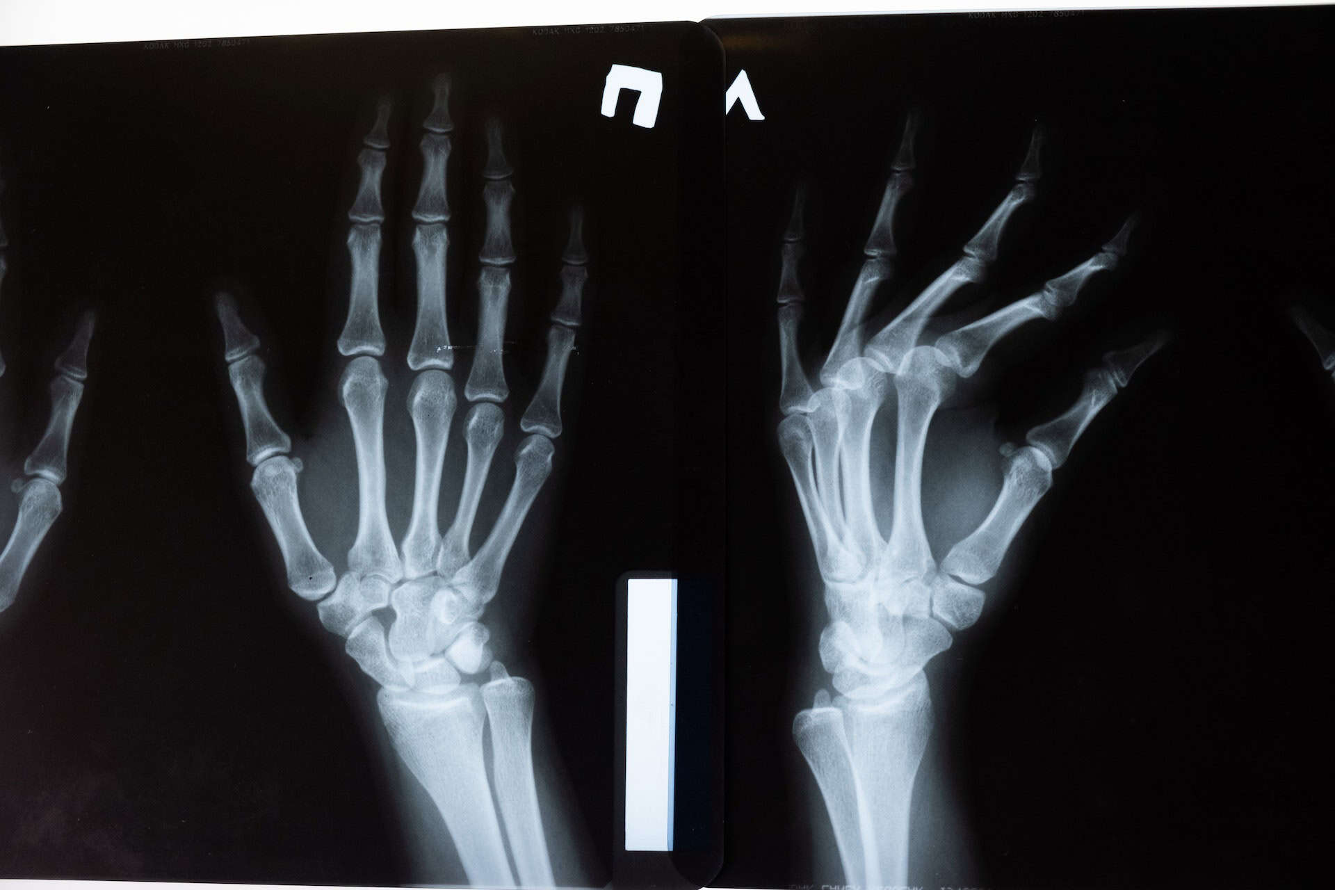 X-rays - Cricket Europe